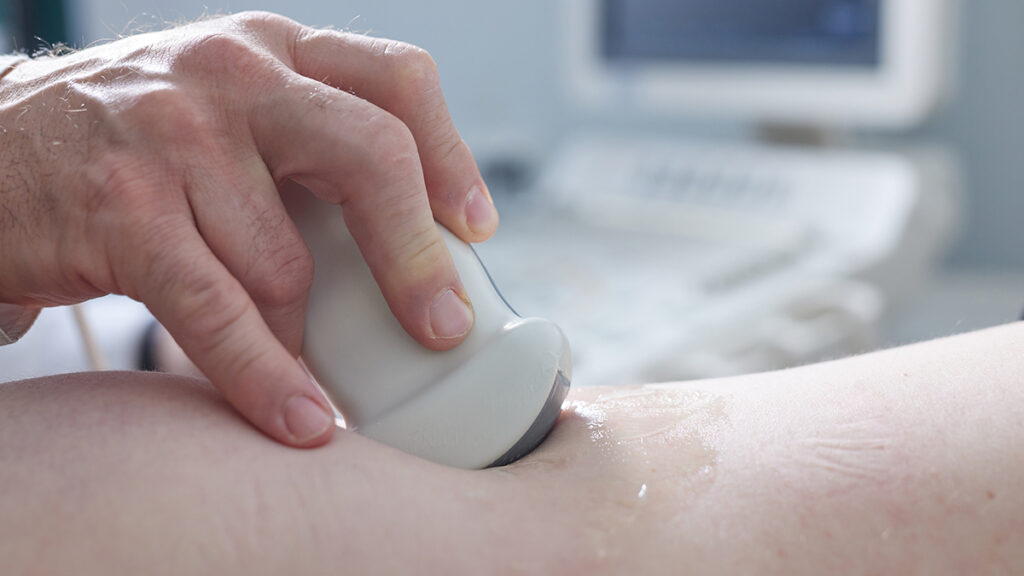 How Does an Ultrasound Work and When Is It Recommended? | Izen Imaging