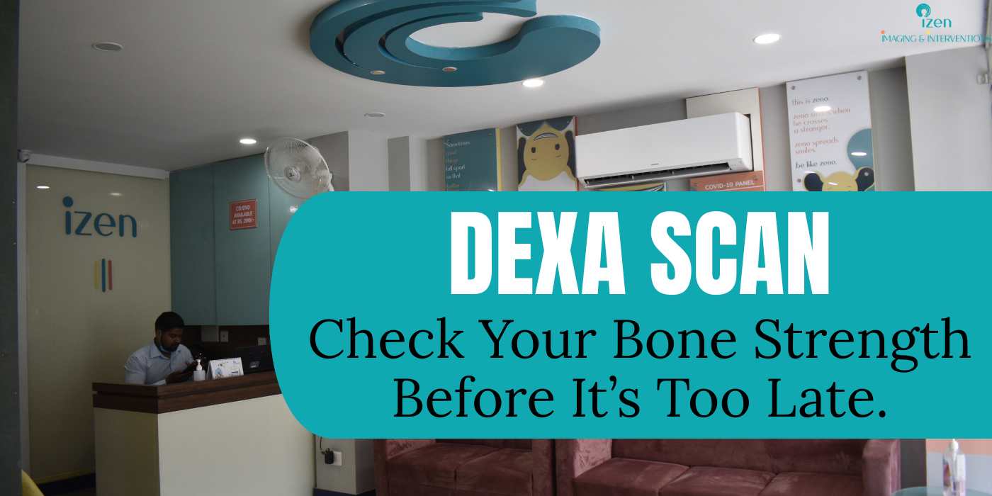 DEXA Scan for Bone Health: Who Needs It, Benefits & When to Get Tested